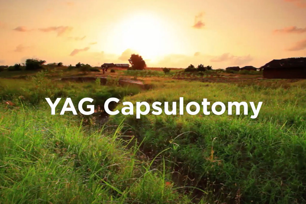 Ophthalmologist in Worcester, MA | Medical Surgical Eye Institute